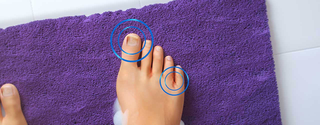 Mycosan Nederland – Alles voor schimmelvrije voeten